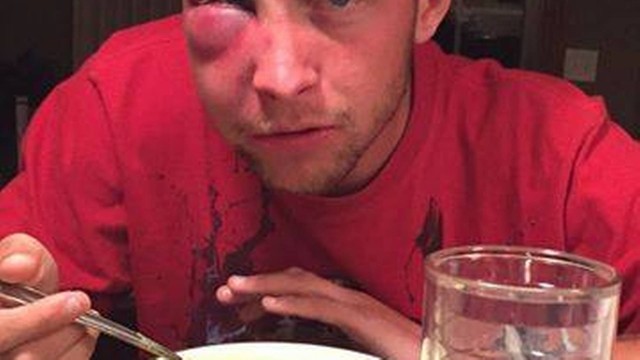 Jovem portador da Síndrome de Asperger é espancado e ensina lição para ...