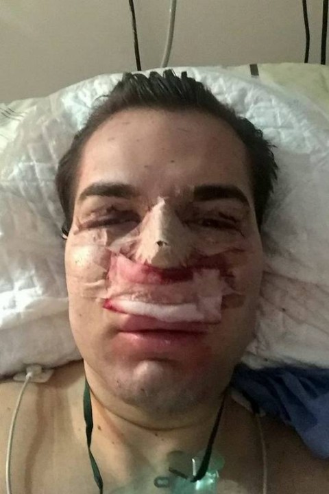 Rosto De Doenca Comedora De Carne