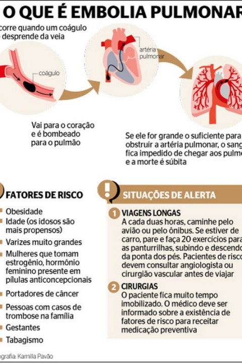 Tratamento De Embolia Pulmonar